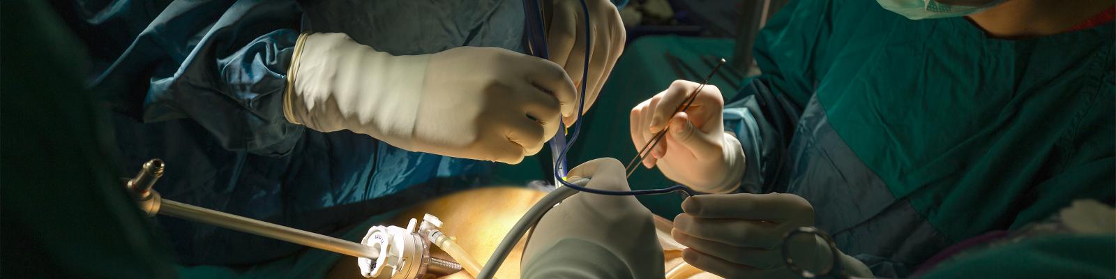 MJ Surgical Clinic | Laparoscopic Gastric Bypass